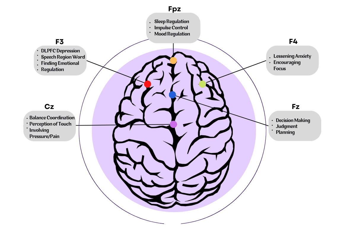 Apollo TMS Technology - Bella Vida TMS
